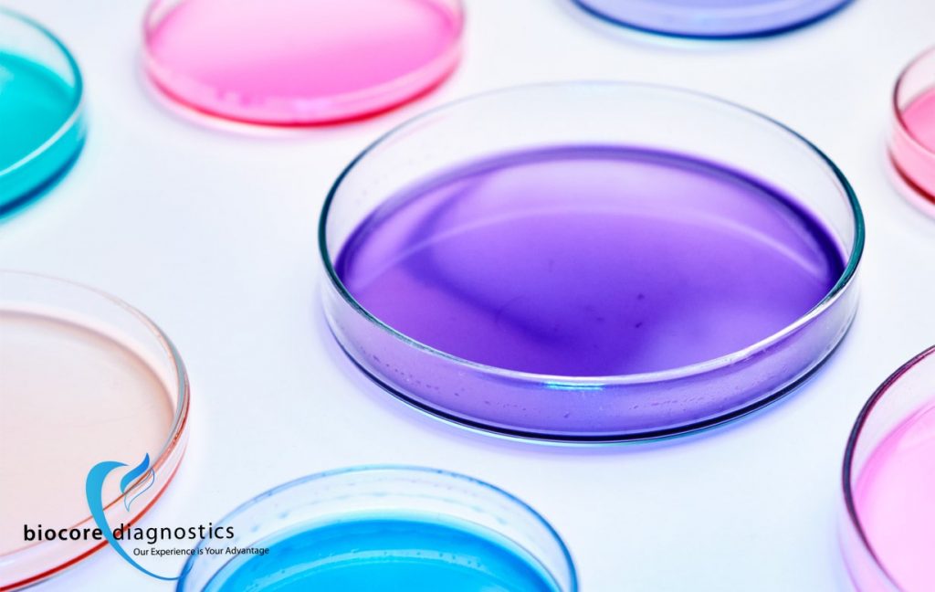 Microbiology / Culture Media Archives - biocore-diagnostics.de